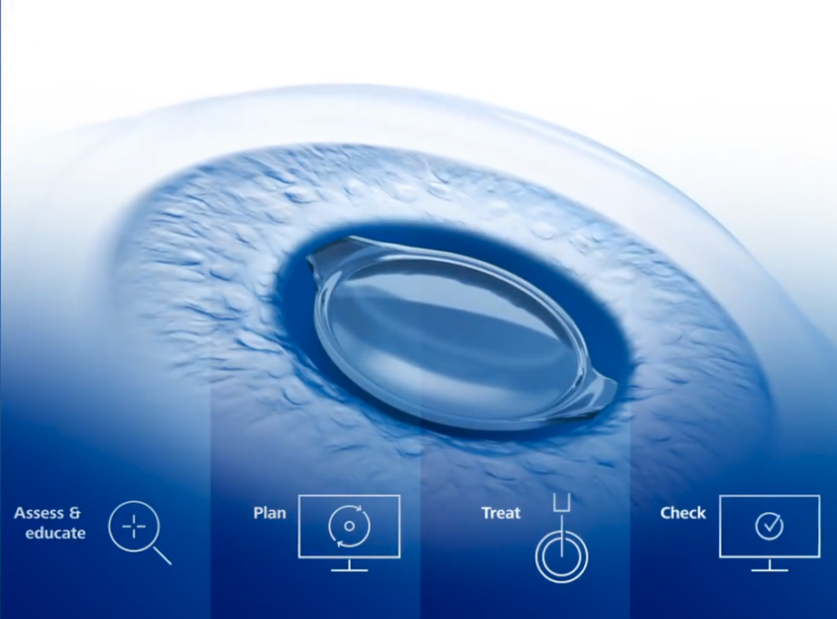 ZEISS Cataract Workflow – Medical Device